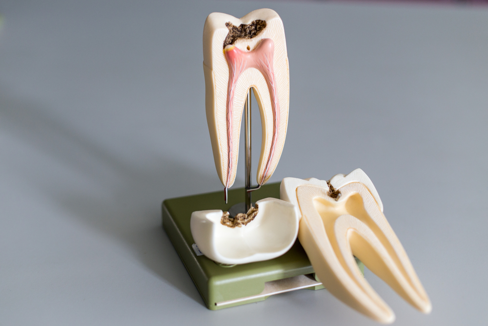 Dental Pulp Damage: Understanding its Causes