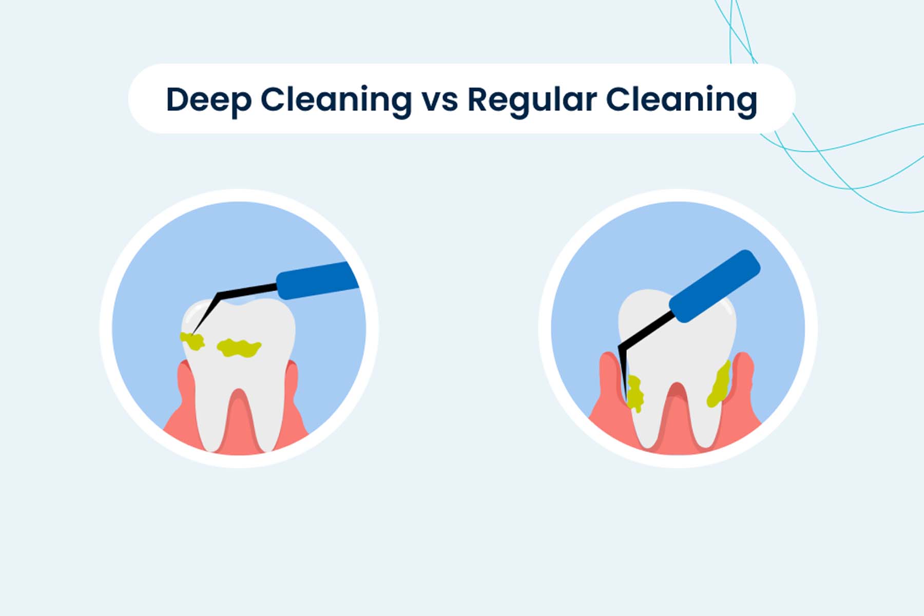 Deep Cleaning vs Regular Cleaning - Garden Oaks Dental